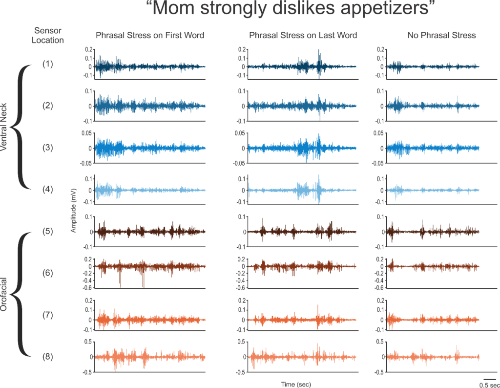EMG Voice; How electromyography is giving a voice to those who cannot ...