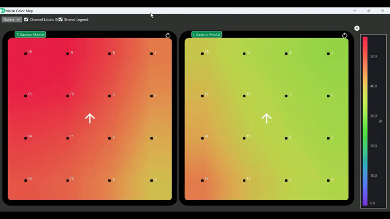 See what’s new in Trigno Discover 1.7.0 - Delsys