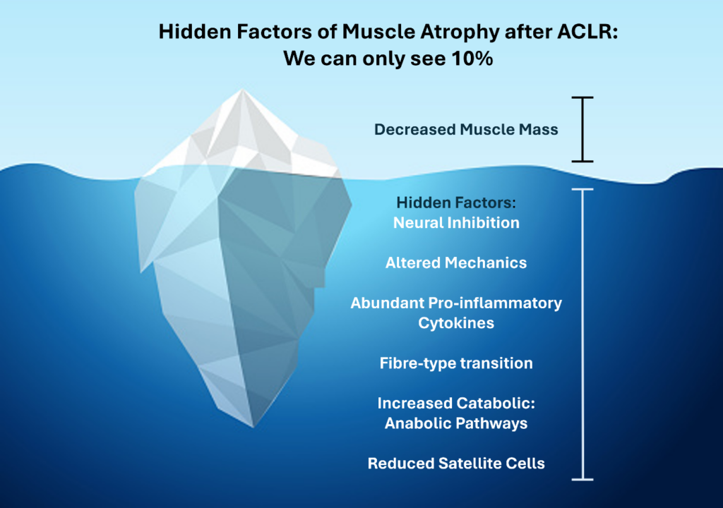 Motor Unit Explorations of ACL Rehabilitation - Delsys