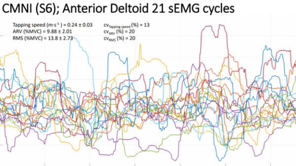 Redefining the Classification System for Paralympic Swimmers - Delsys