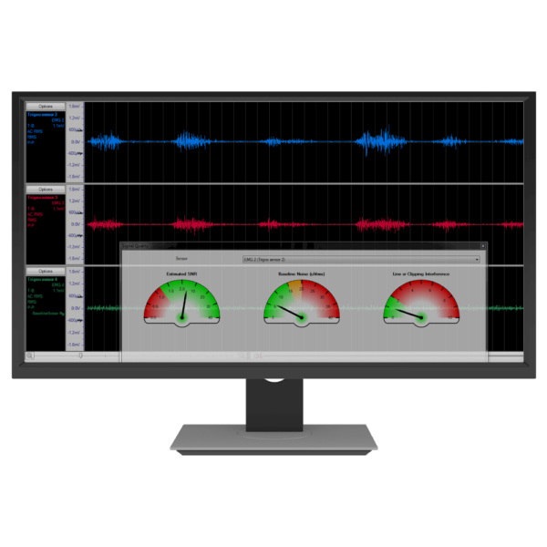 Signal Quality Monitor Support - Delsys