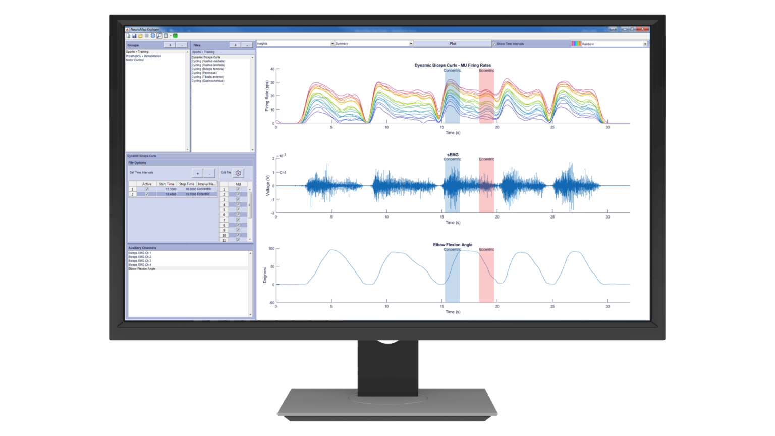 Neurophysiology - Delsys